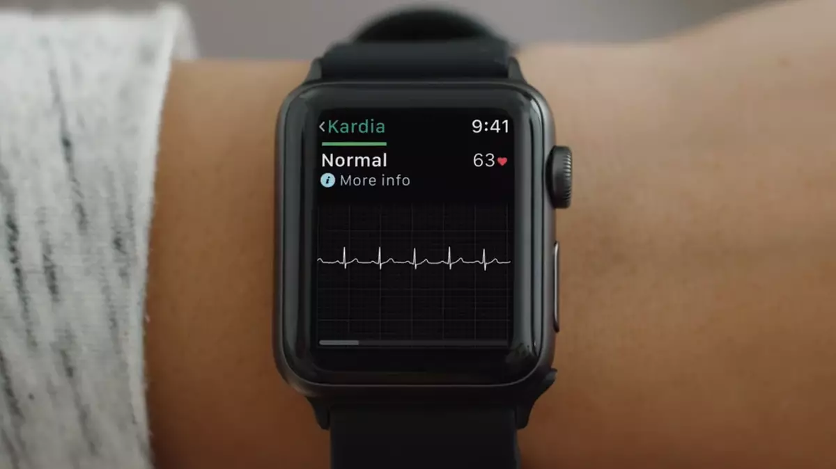 EKG in Apple Watch 4 kann jetzt versucht werden 6057_0